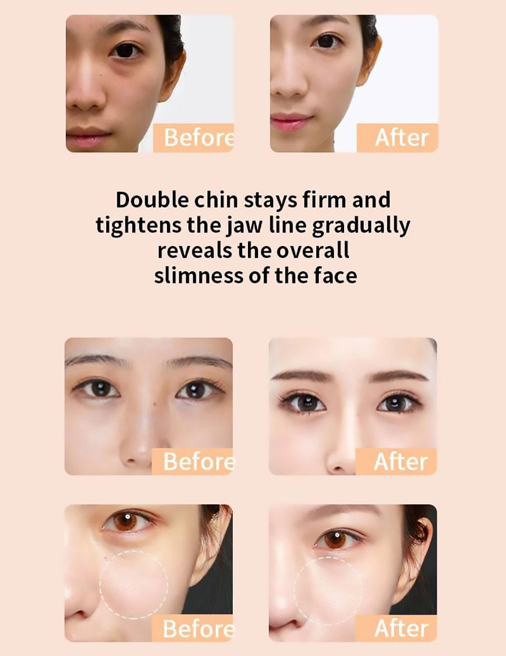 HS-989 RF Instrument Color Light Pulse Beauty Instrument Red