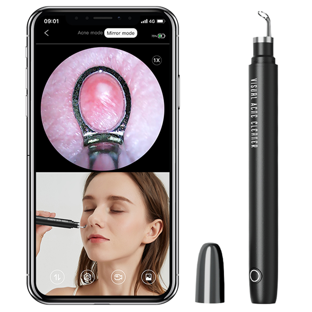 SUNUO M5 Smart Visual Acne Cleaner