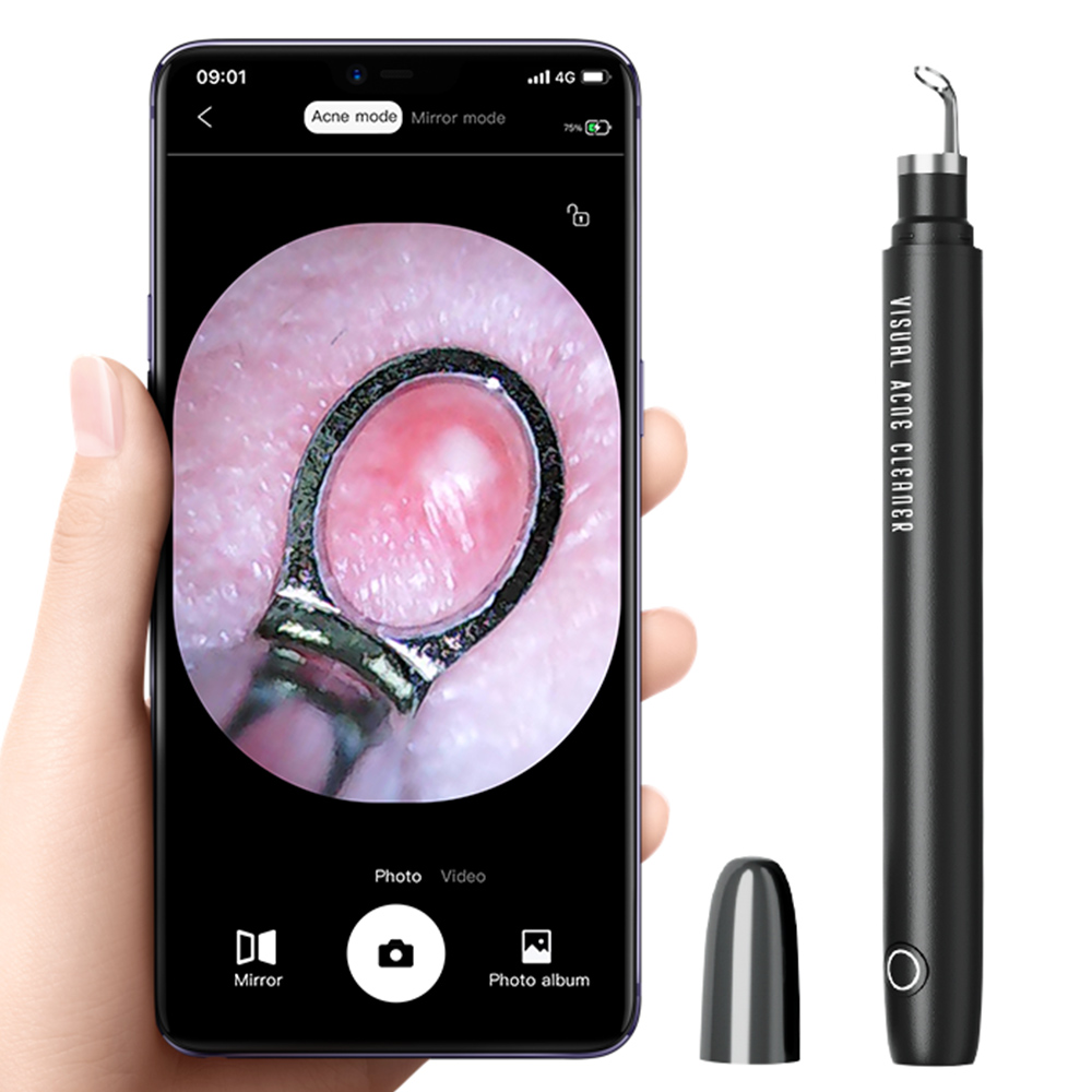 SUNUO M5 Smart Visual Acne Cleaner