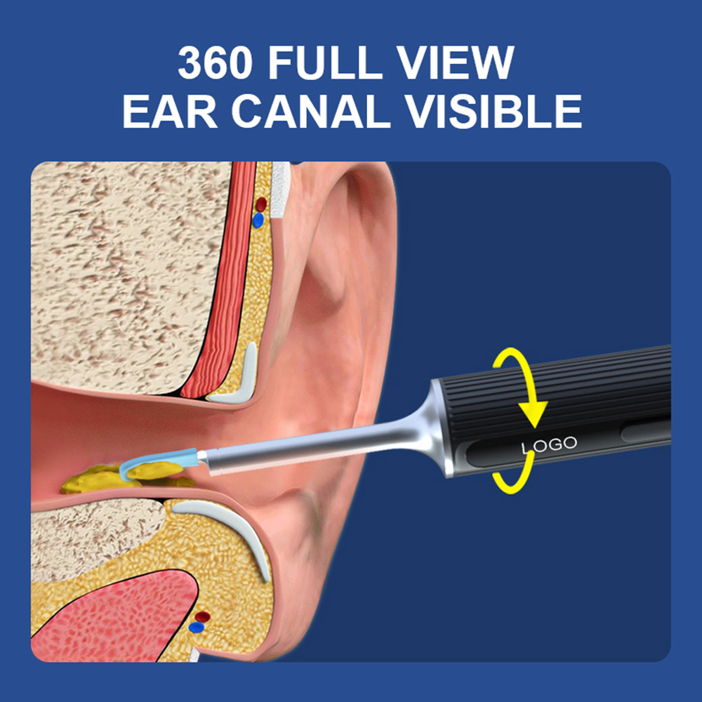 SUNUO X8 Smart Visual Ear Cleaner